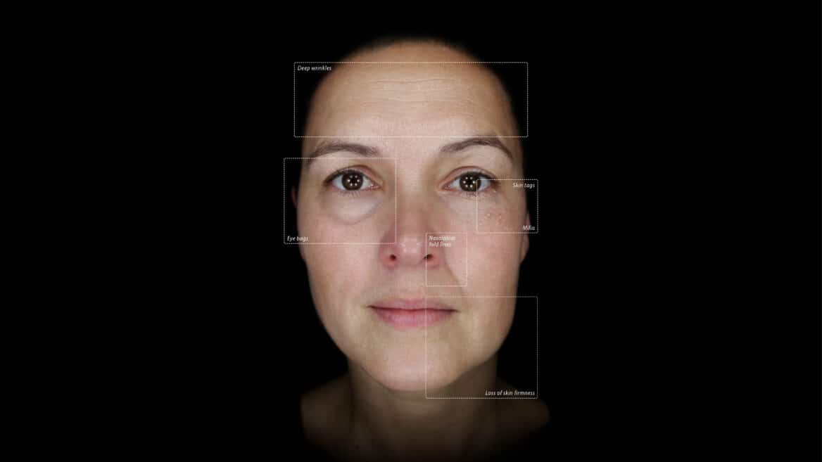 Alma IQ | Alma Lasers - almainc.com