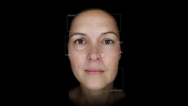 Alma IQ | Alma Lasers - almainc.com
